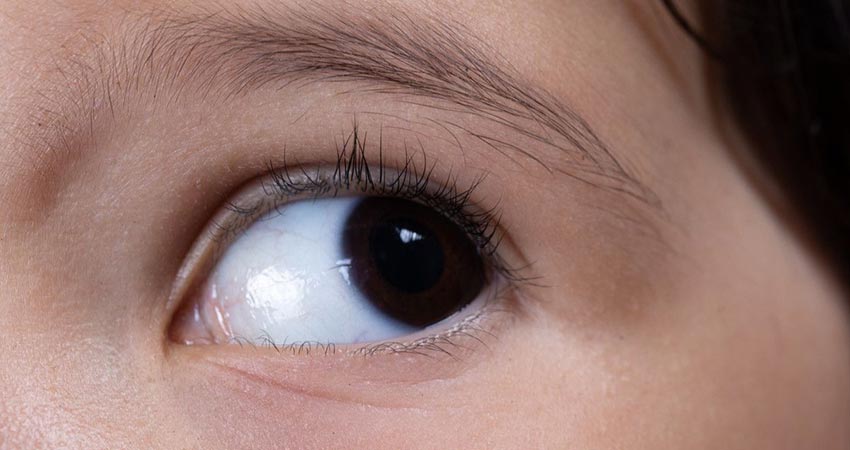 Entendendo o nistagmo infantil: causas, diagnóstico e tratamento - Dra ...